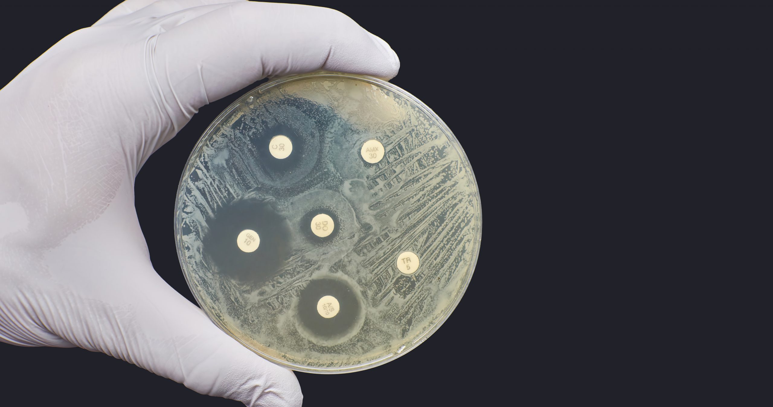labellisation des antibiogrammes ciblés pour les ECBU